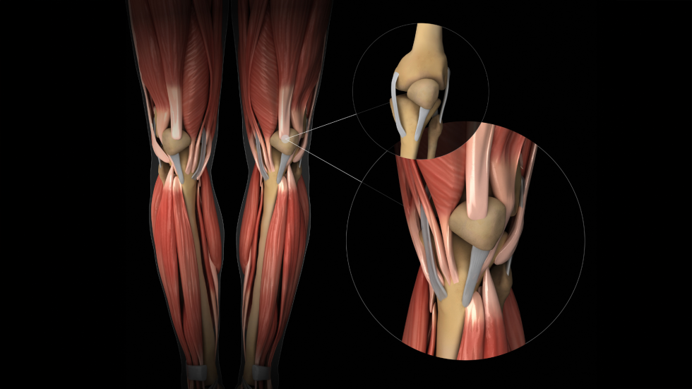 How Your Diet Can Affect Your Tendon Health - Buffalo Rehab Group